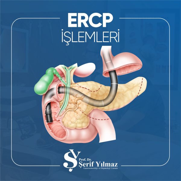 ERCP - Prof. Dr. Şerif YILMAZ